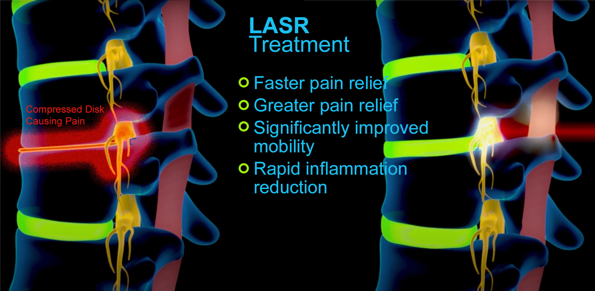LASR Decompression - Unique Family Chiropractic & Wellness Centre